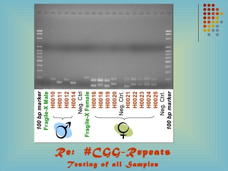 Fragile X Syndrome Mutation By Methylation Sensitive Pcr