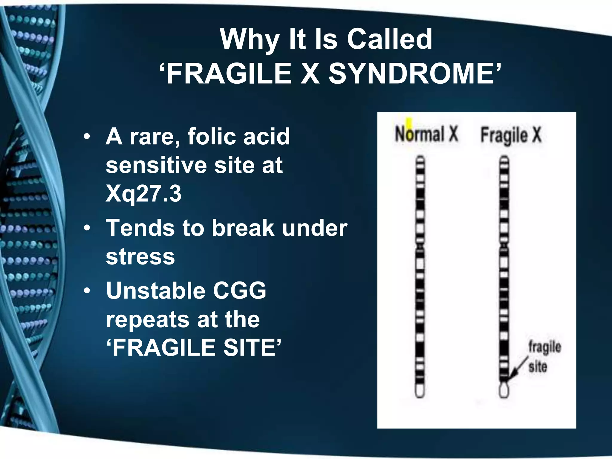 Fragile x syndrome | PPTX