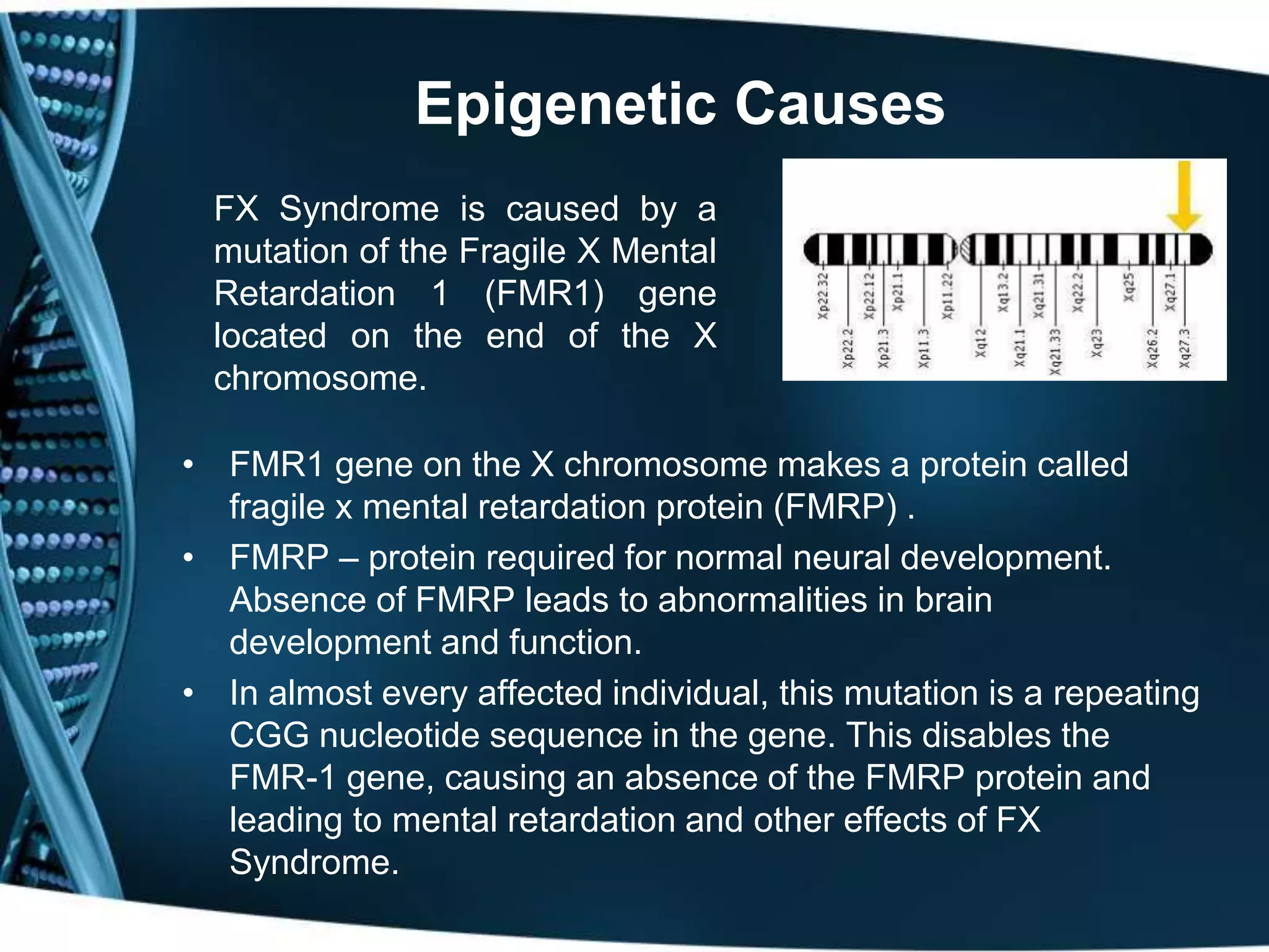 Fragile x syndrome | PPTX