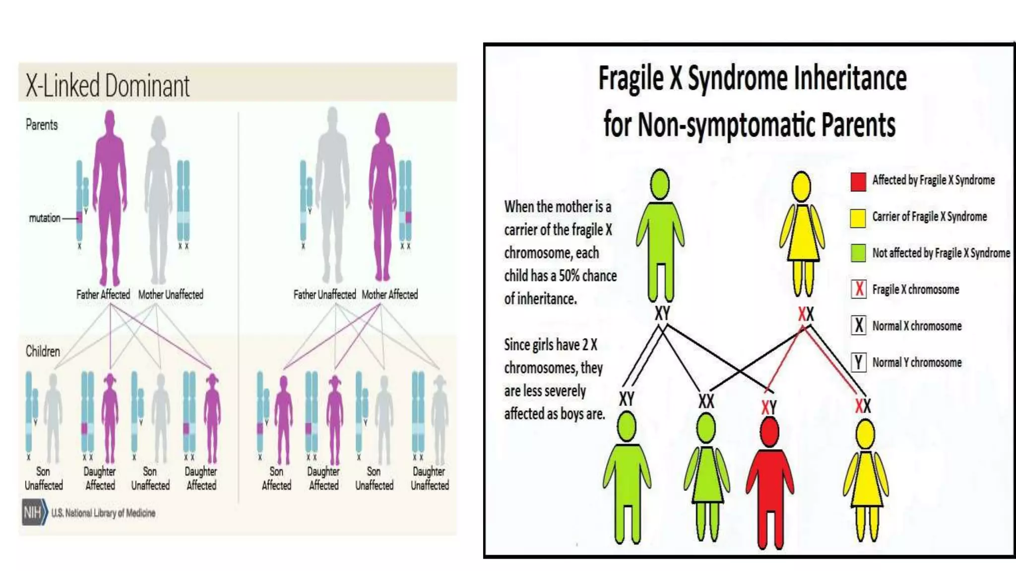 Fragile x syndrome | PPTX