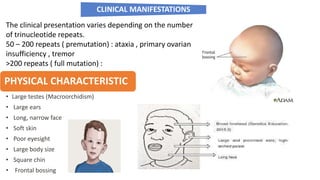 Fragile x syndrome | PPTX