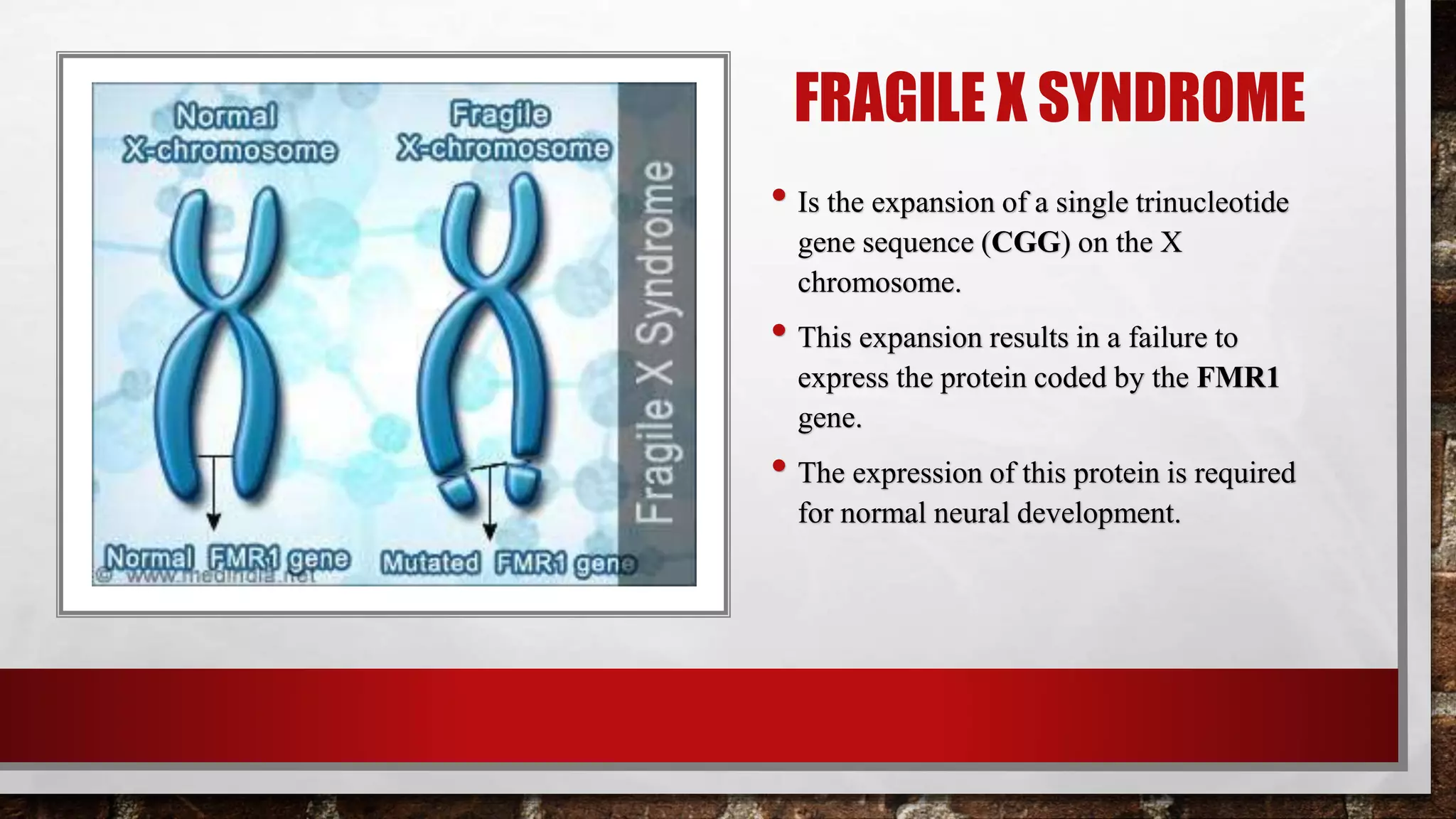fragile x syndrome.pptx