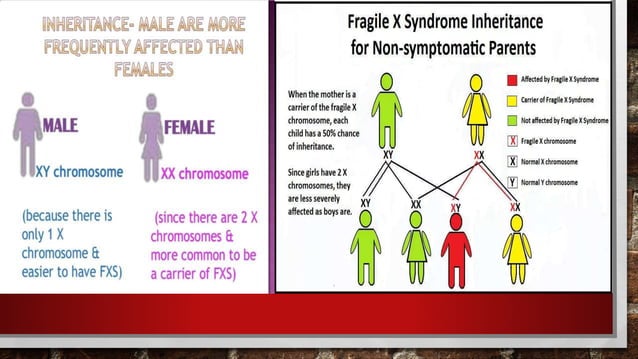 fragile x syndrome.pptx