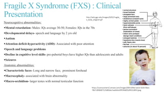 Fragile X Syndrome (FXS) | PPTX