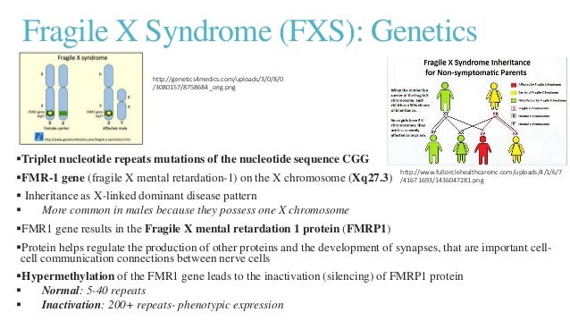 Fragile X Syndrome (FXS)