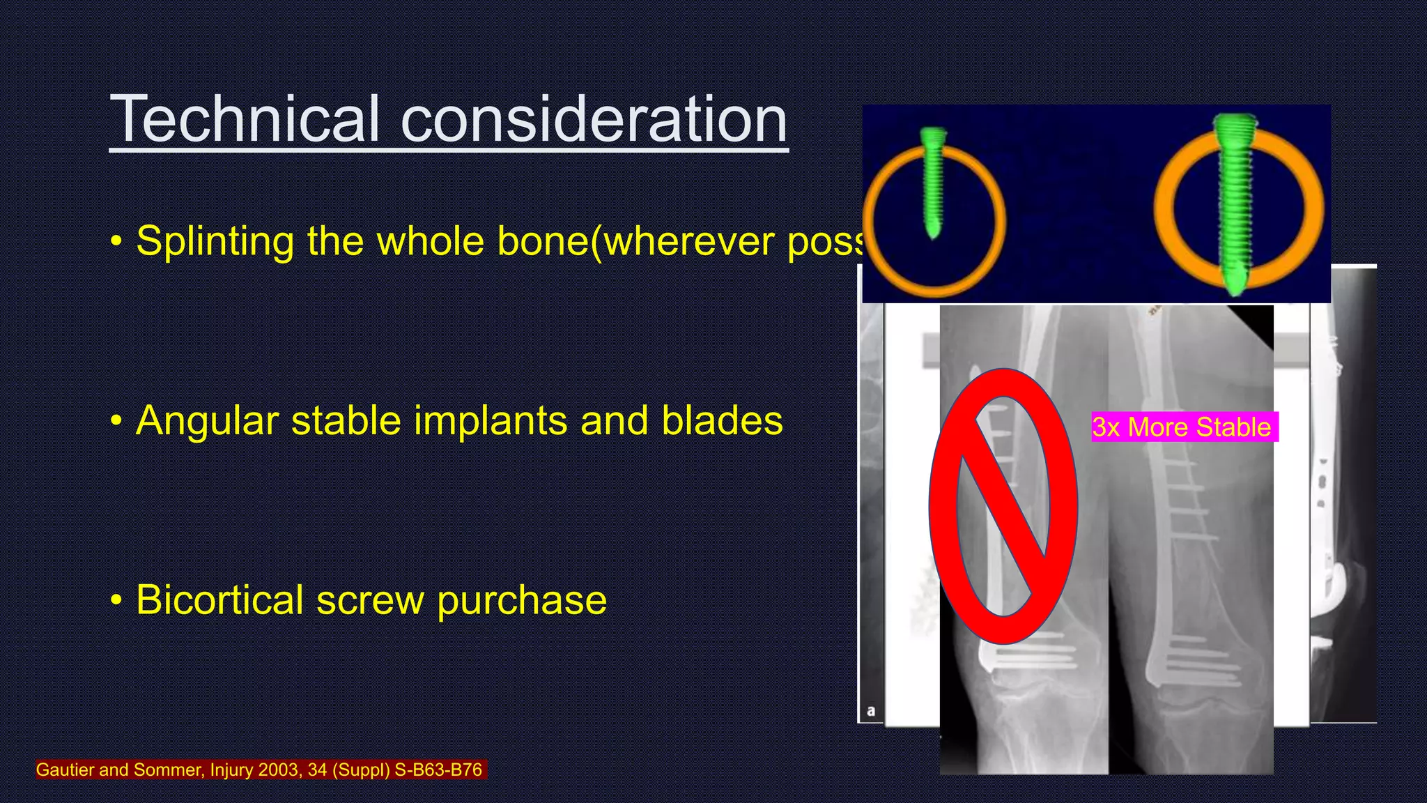 Fragility fractures | PPTX