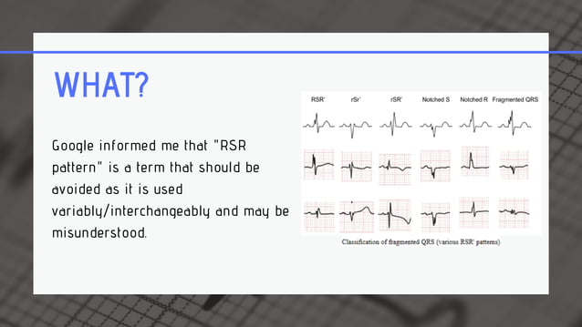 Fragmented QRS | PPT
