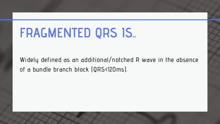 Fragmented QRS | PDF