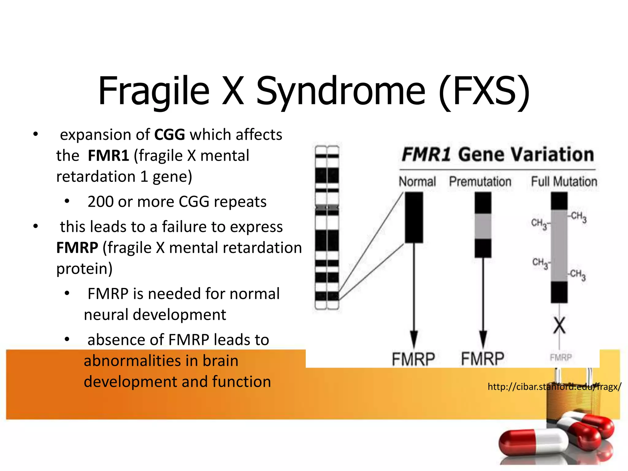 Why Fragile X syndrome | PPTX