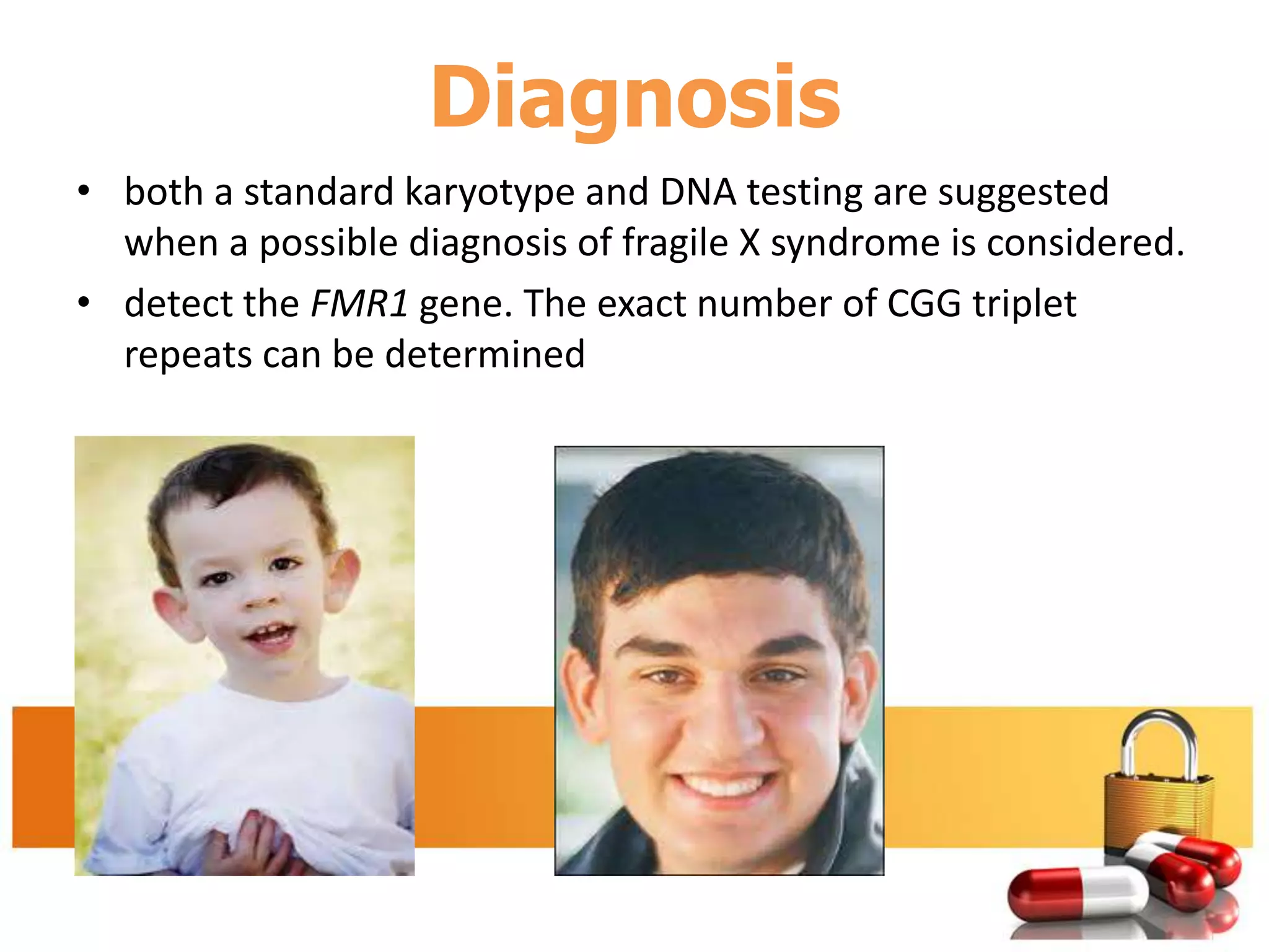 Why Fragile X syndrome | PPTX