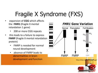Why Fragile X syndrome | PPT