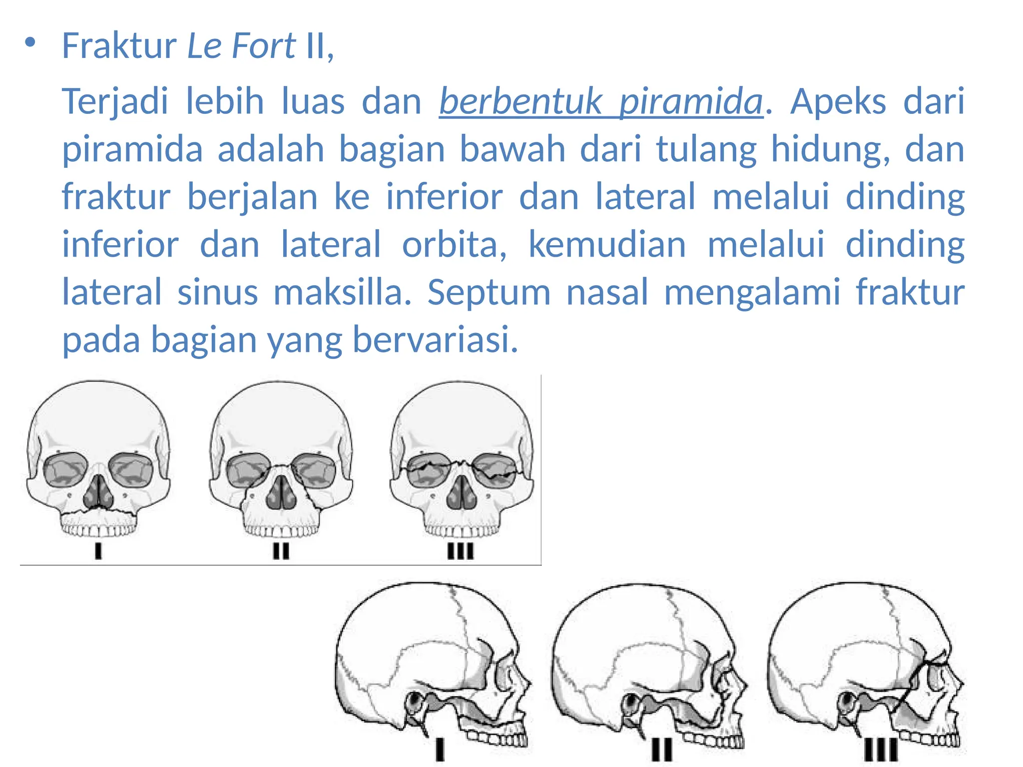 Fraktir tulang: Lokasi anatomi dan perluasan Tipe fraktur Alignment dan ...