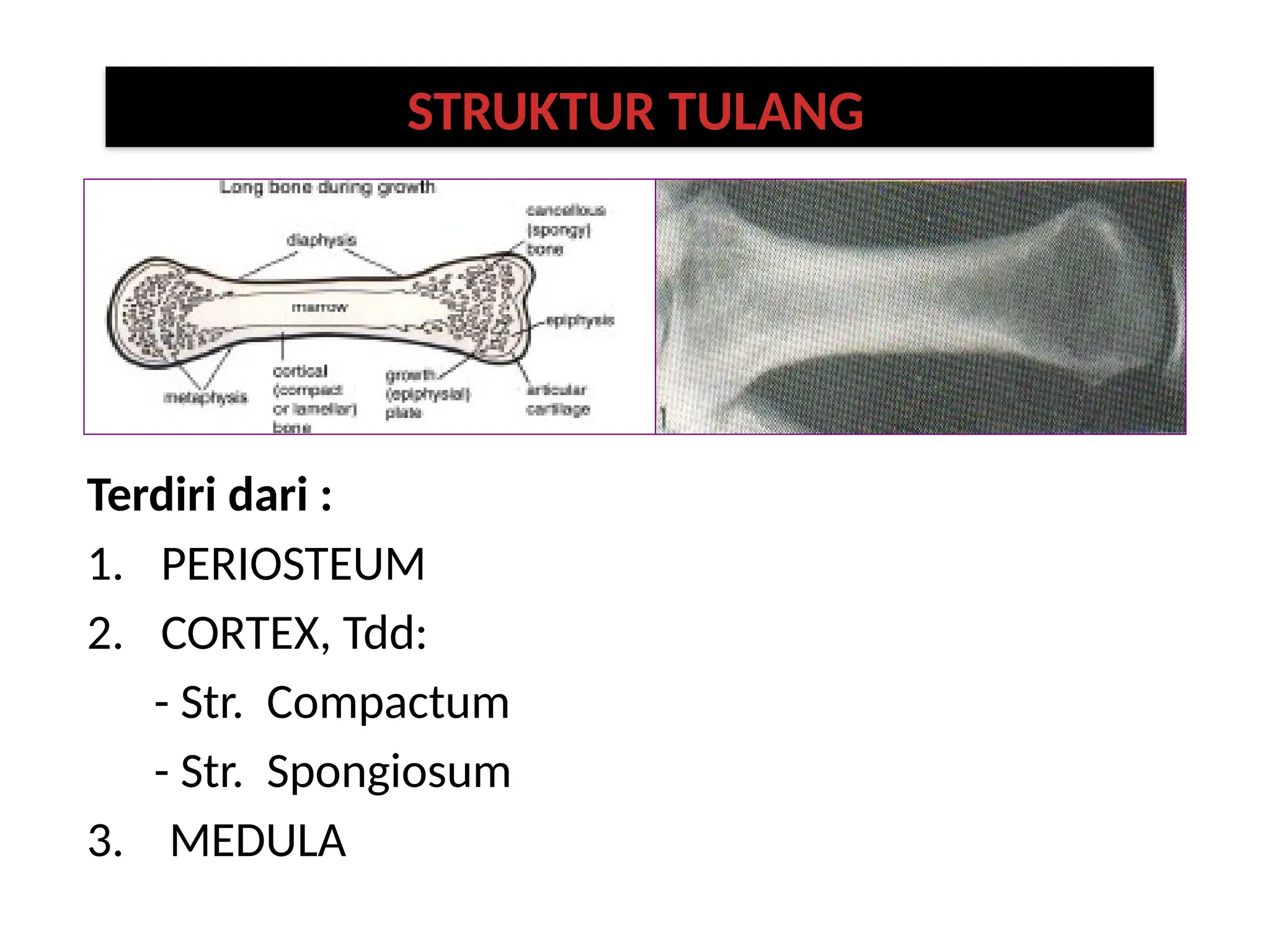Fraktir tulang: Lokasi anatomi dan perluasan Tipe fraktur Alignment dan ...