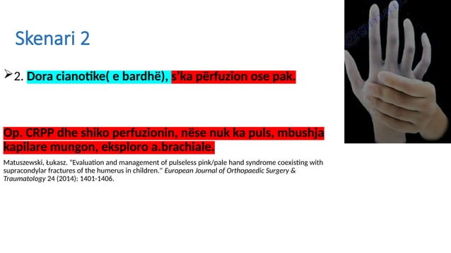 Frakturat suprakondilare te humerusit tek femijet.pptx