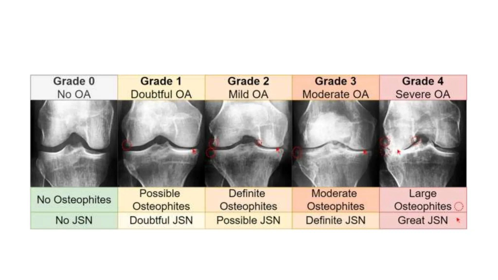 FRAKTUR CALVARIA FOTO WATERS PERBEDAAN OA RA.pptx