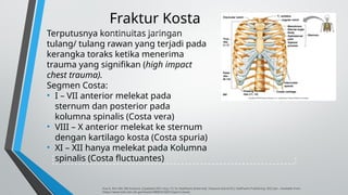 FRAKTUR COSTA. Case report dan pembahasan.pptx