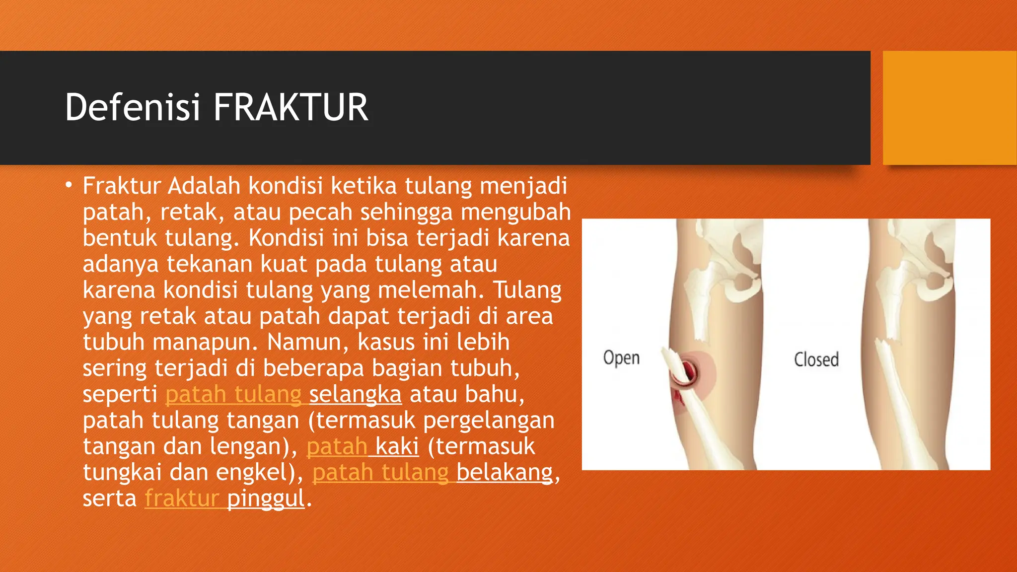 Penanganan Fraktur (Patah Tulang) fix. ppt | PPTX