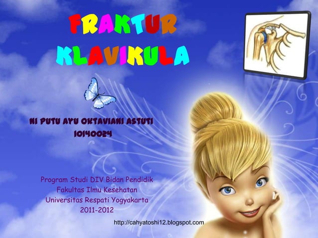 Fraktur klavikula | PPTX