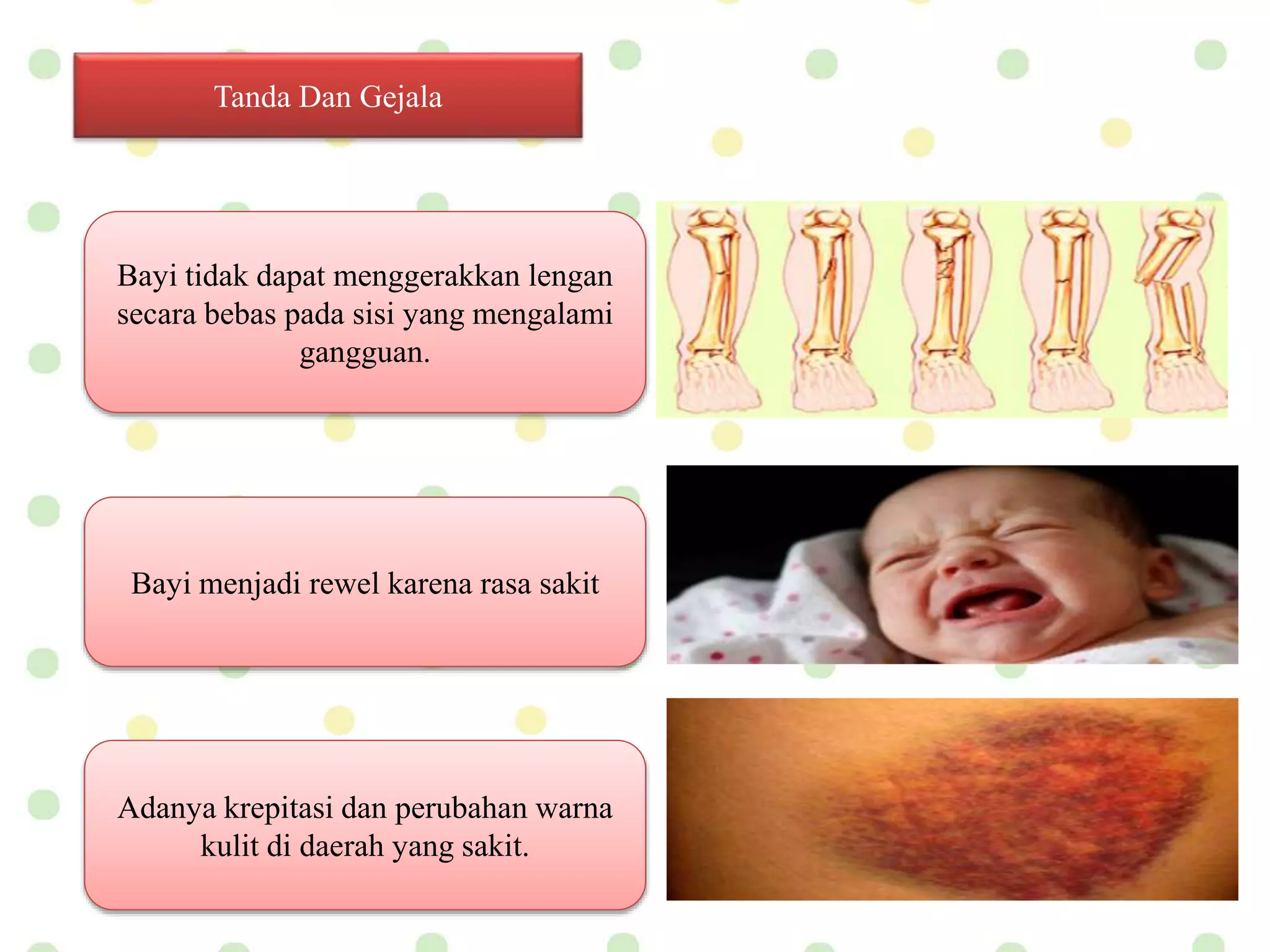 Fraktur klavikula | PPTX