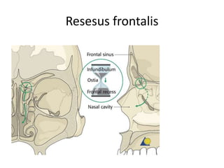 Fraktur sinus frontal | PPTX