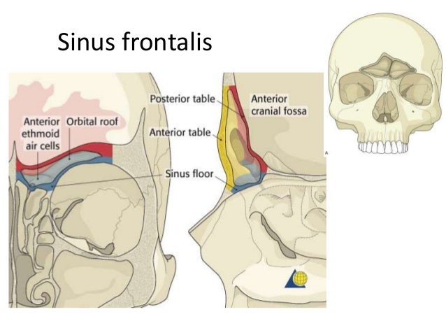 Fraktur sinus frontal