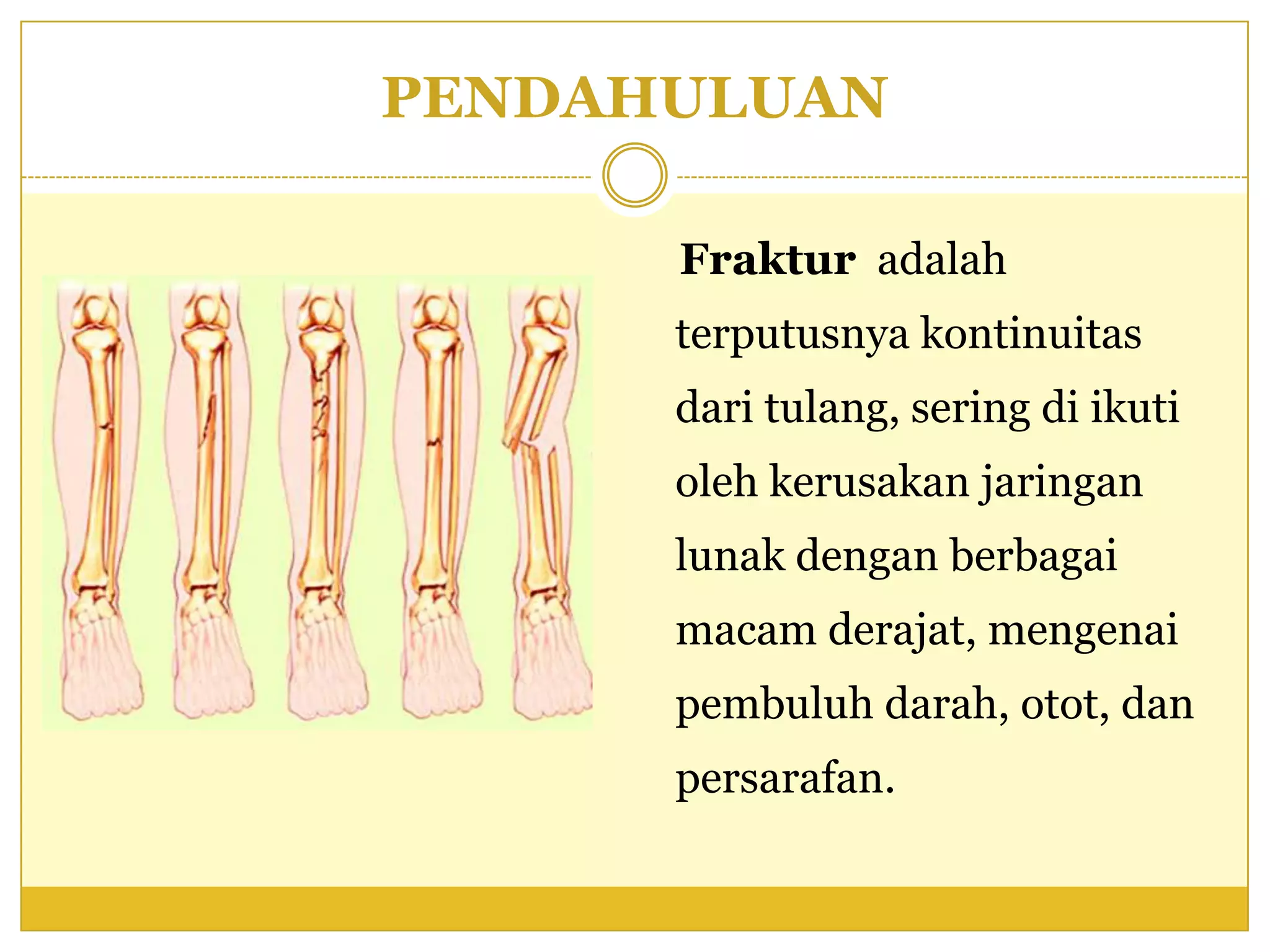 Fraktur tibia | PPTX