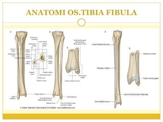Fraktur tibia | PPTX