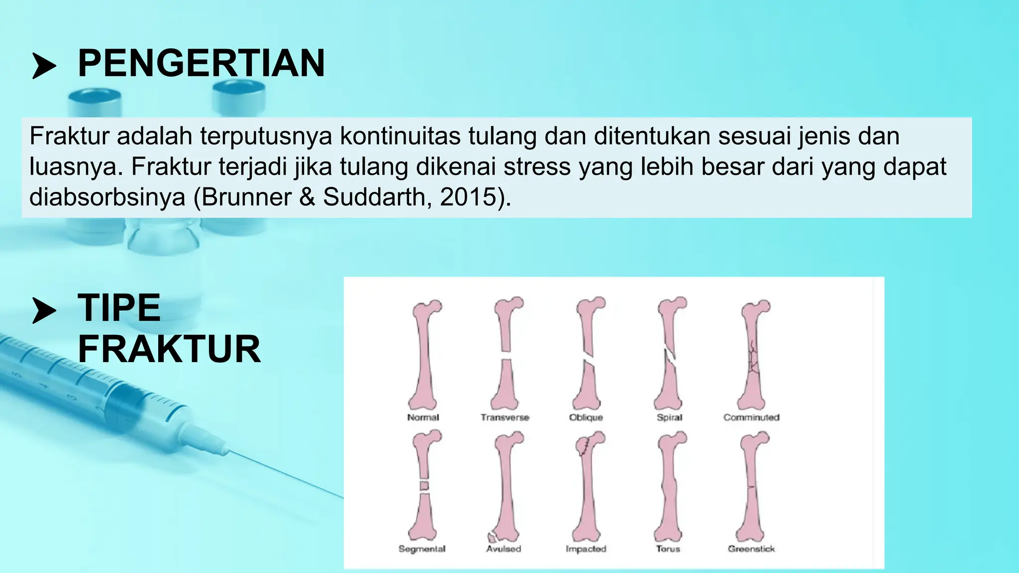 Fraktur tibia fisiologi anatomy assessmrnt | PDF