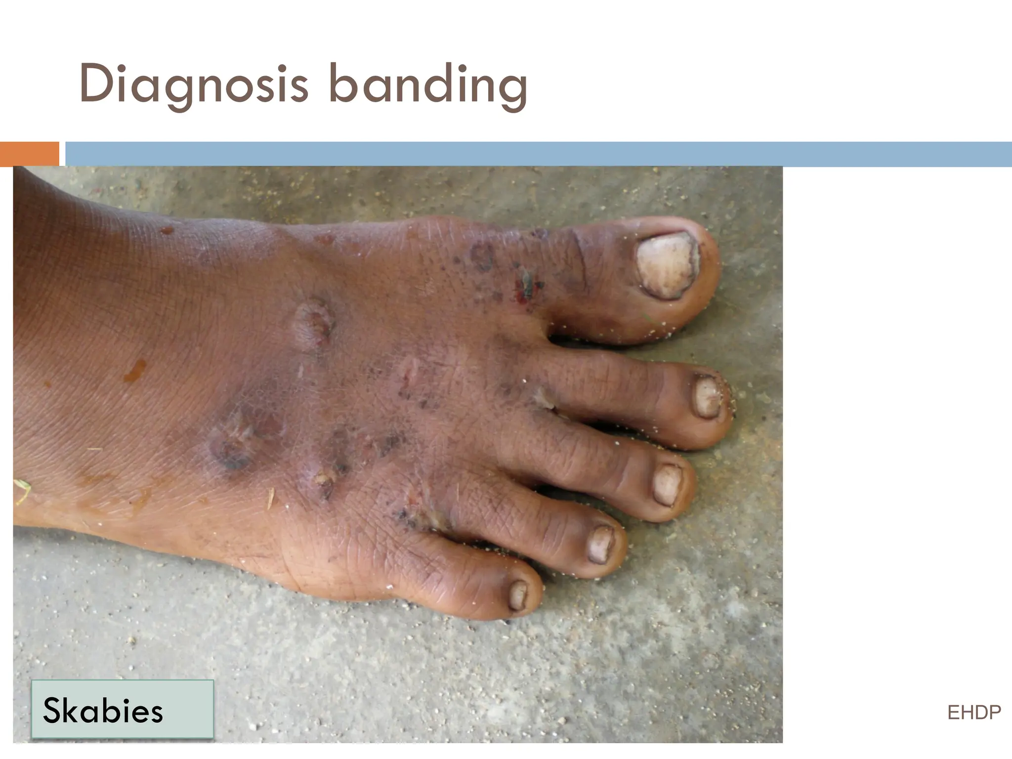 FRAMBUSIA MATERI NEW UPDATE 2024 1233455 | PDF