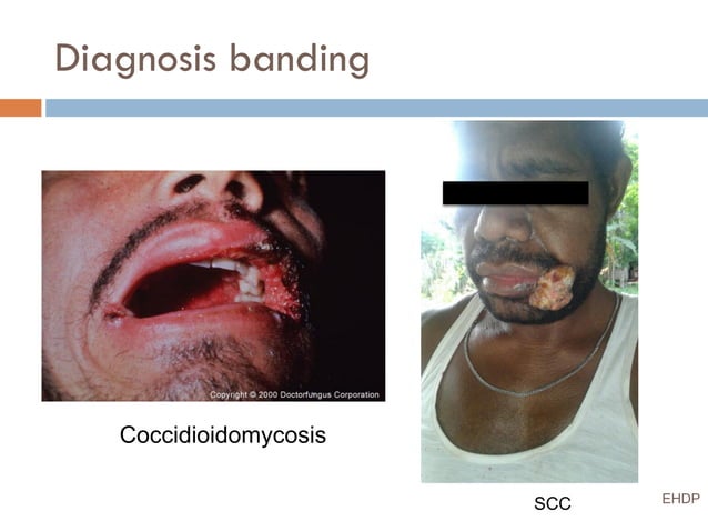 FRAMBUSIA MATERI NEW UPDATE 2024 1233455 | PPT