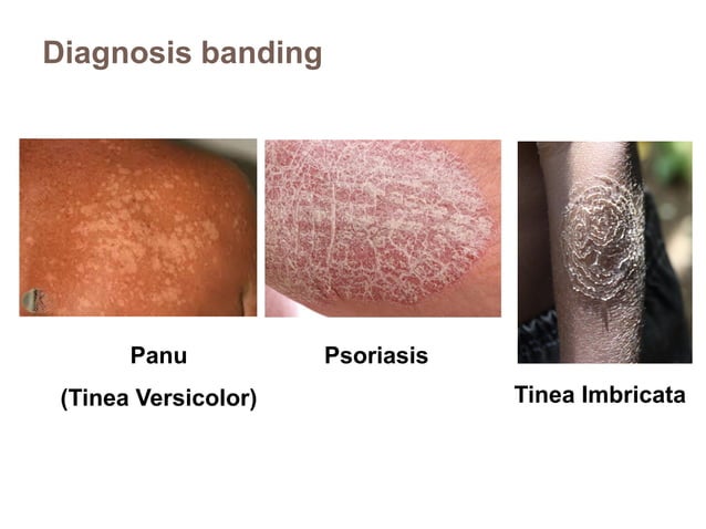 FRAMBUSIA MATERI NEW UPDATE 2024 1233455 | PPT