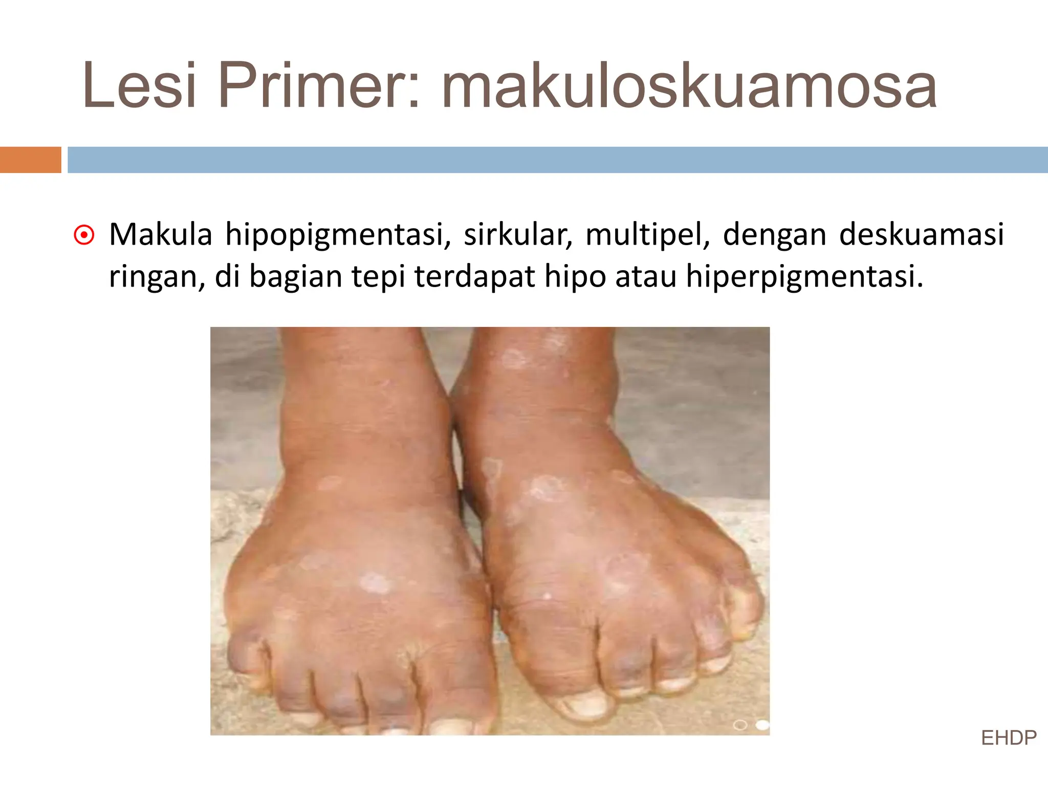 Frambusia PPT.pptx