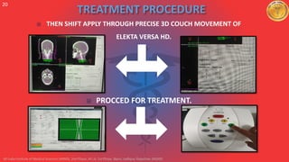 FRAMELESS BASED SRS AND SRT | PDF
