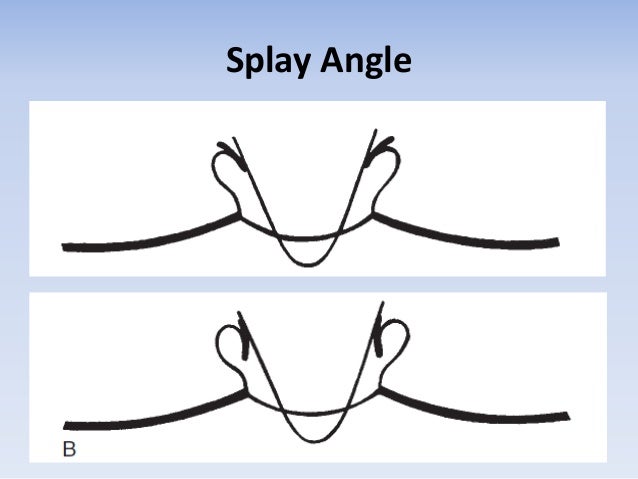 Frames and frame measurements__optometry_india_eyenirvaan.com