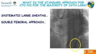 Francesco Burzotta: Tips & tricks on radial CTO-PCI | PDF