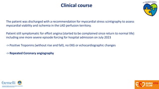 Francesco Burzotta: Wrap up Gemelli Cases | PDF