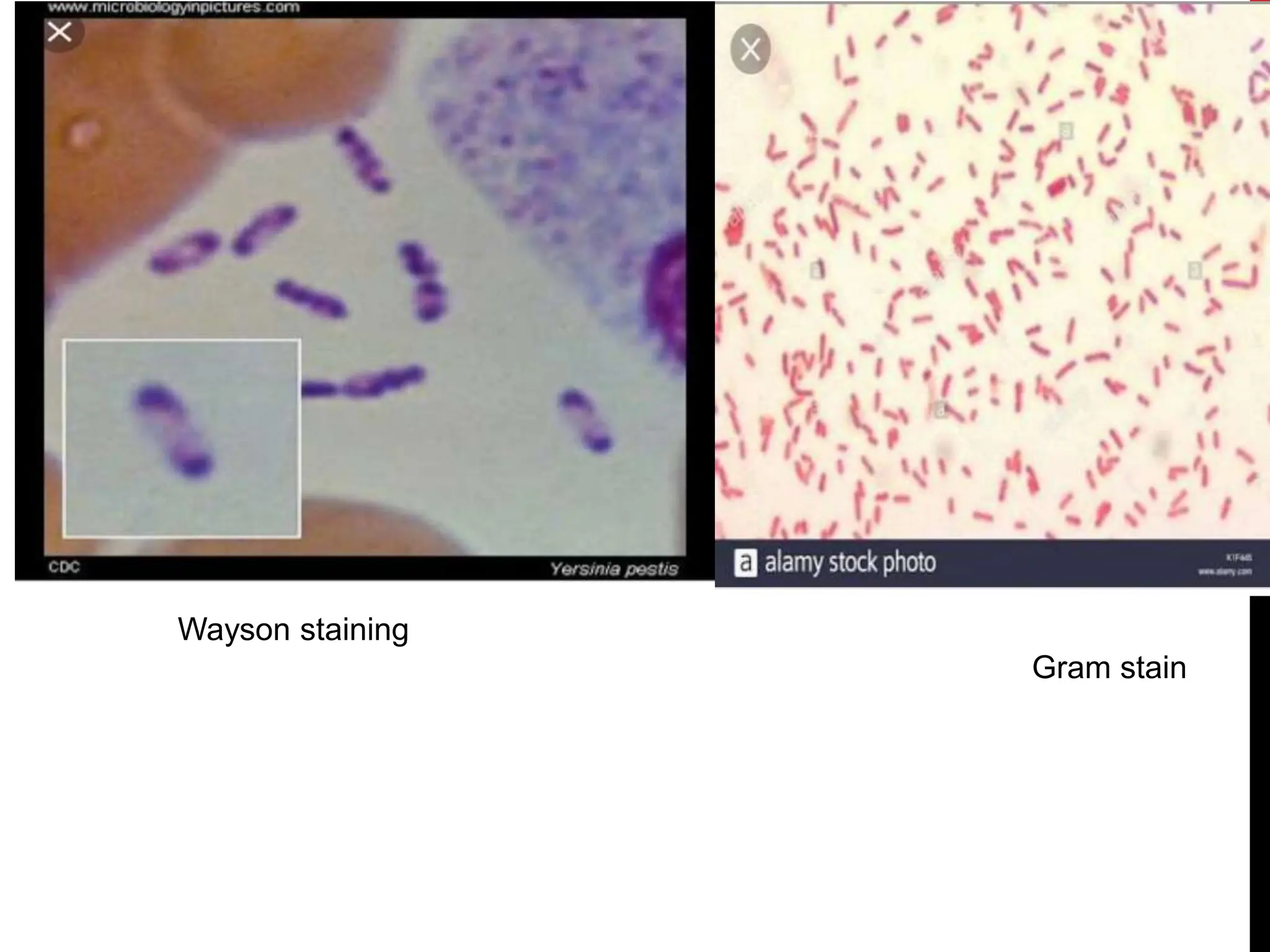 francisella AND YERSINIA.pptx for education | PPTX