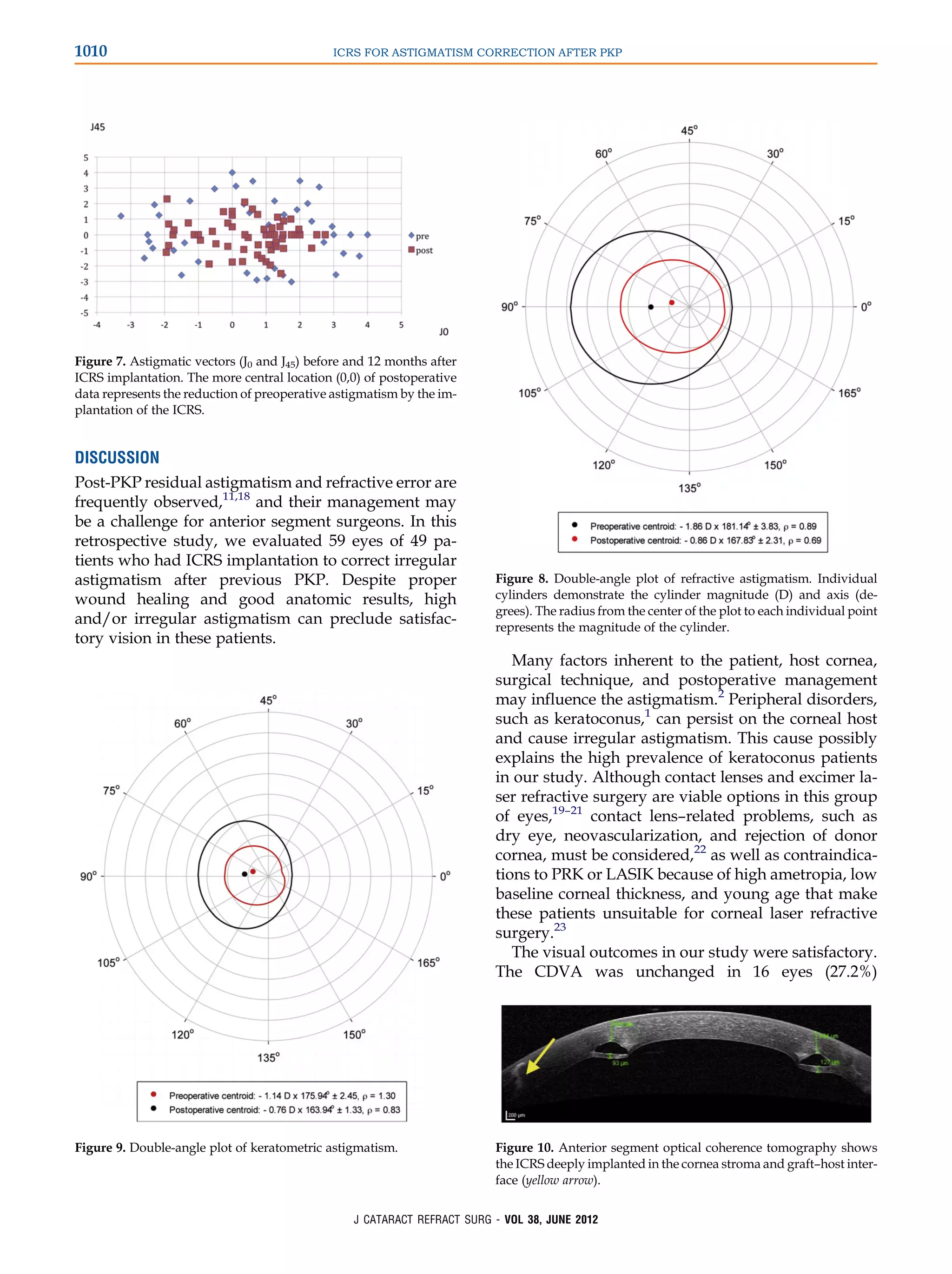 FR and the astigmatism after penetrating keratoplasty | PDF