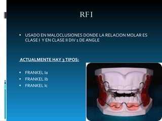 Frankel | PPT