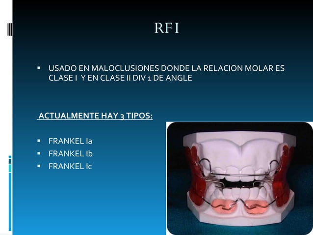 Frankel | PPT