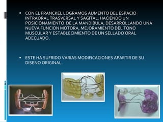 Frankel | PPT