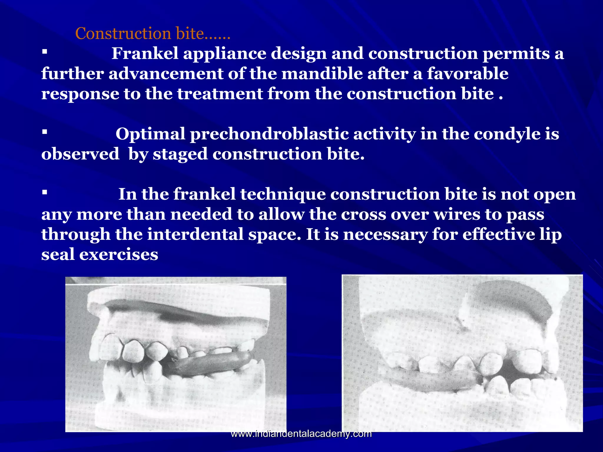 Frankel functional appliance | PPT