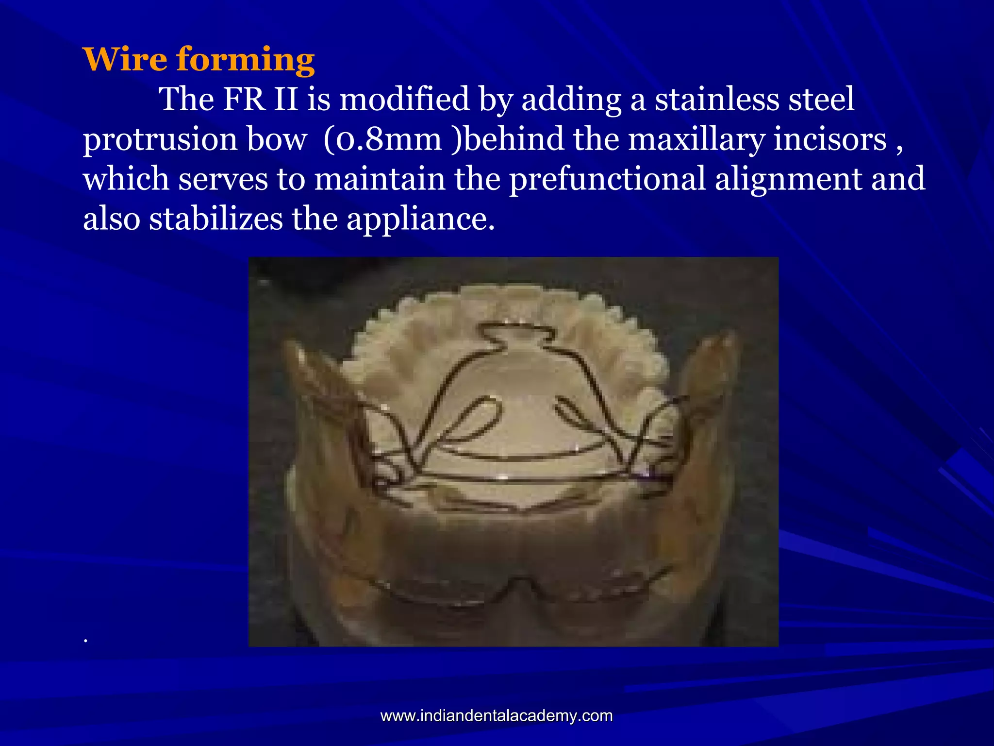 Frankel functional appliance | PPT