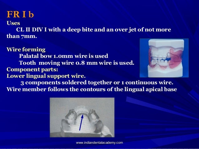 Frankel functional appliance