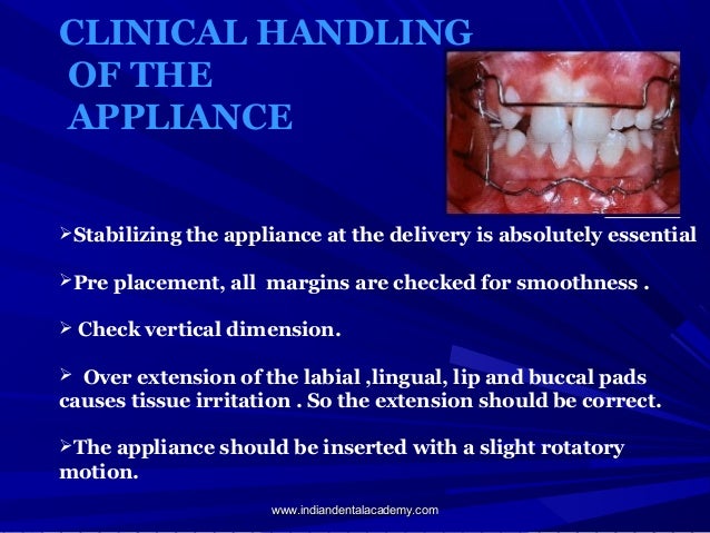 Frankel functional appliance