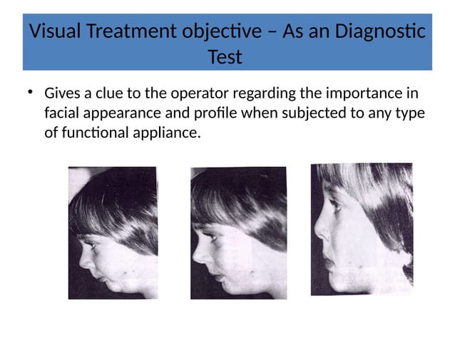 frankel functional regulator orthodontics.pptx