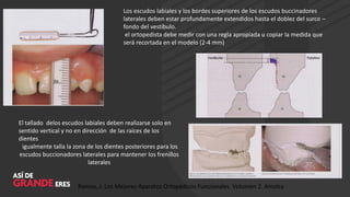 Aparato de ortopedia frankel_III final .pdf