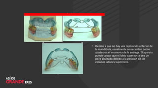 Aparato de ortopedia frankel_III final .pdf