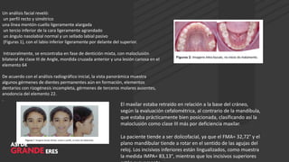 Aparato de ortopedia frankel_III final .pdf