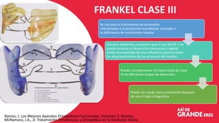 Aparato de ortopedia frankel_III final .pdf